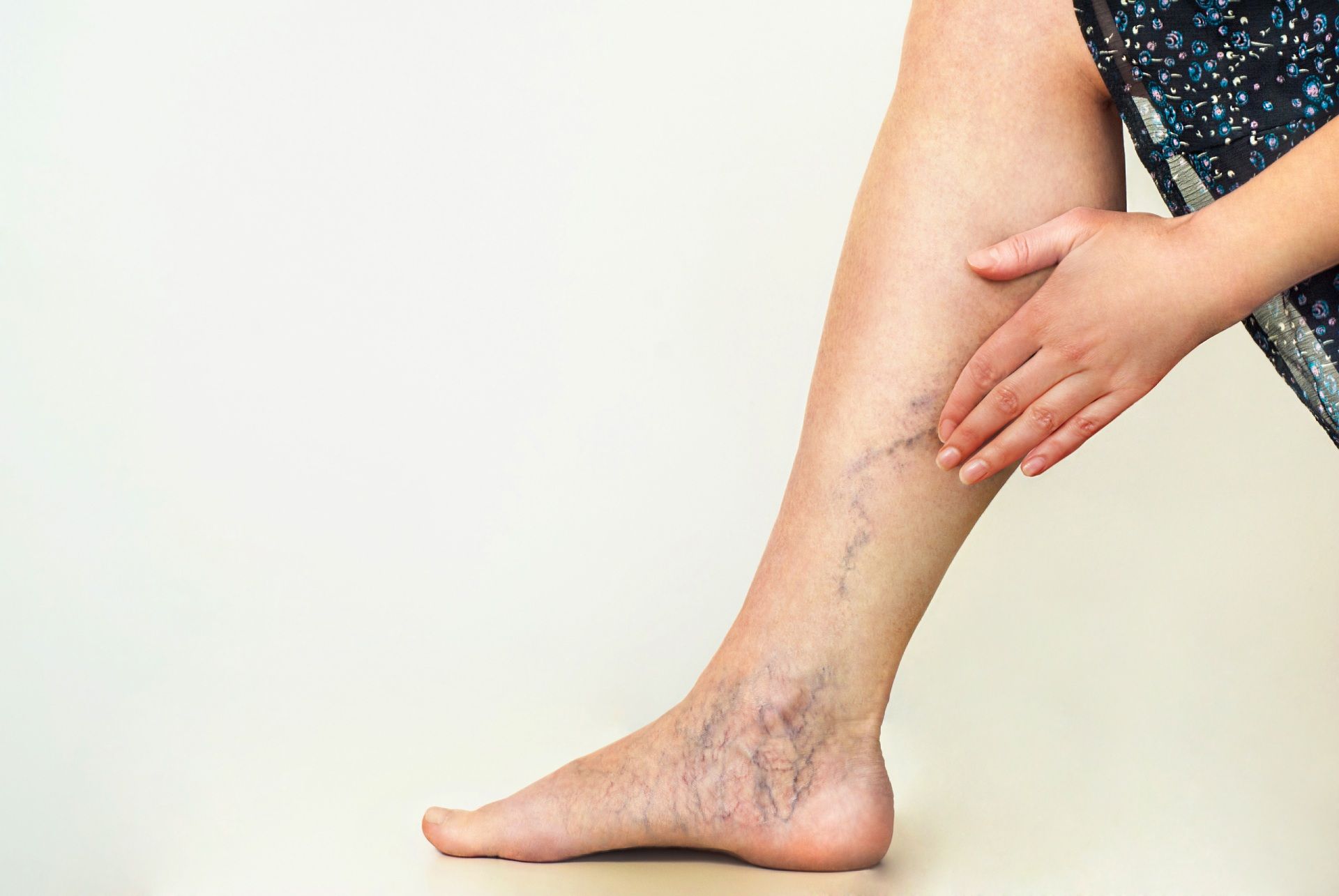 Gefäßchirurgie Franken – Ihre Experte für gesunde Venen