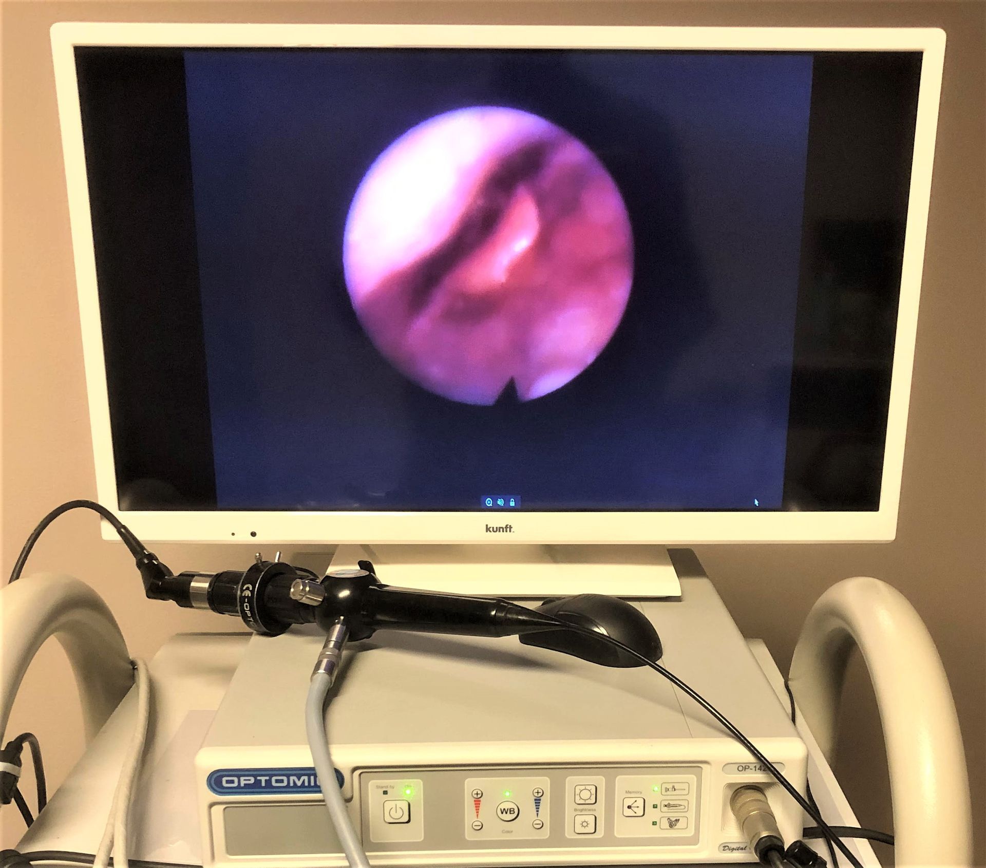 Crirugia Laser - Médico de Otorrinolaringologia - Vera Cruz