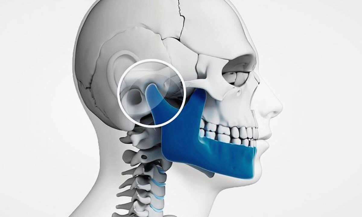 O QUE É AFINAL A ARTICULAÇÃO TEMPOROMANDIBULAR